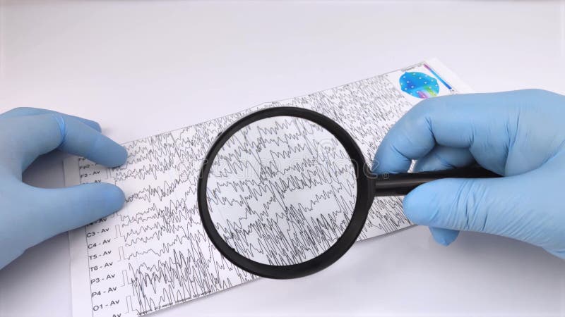 A Neurologist Examines an Encephalogram of a Patientâ€™s Brain ...