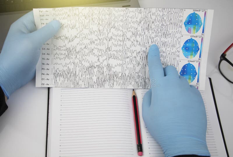 A Neurologist Examines an Encephalogram of a Patientâ€™s Brain ...