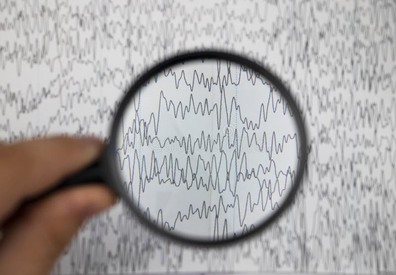 A Neurologist Examines an Encephalogram of a Patientâ€™s Brain ...