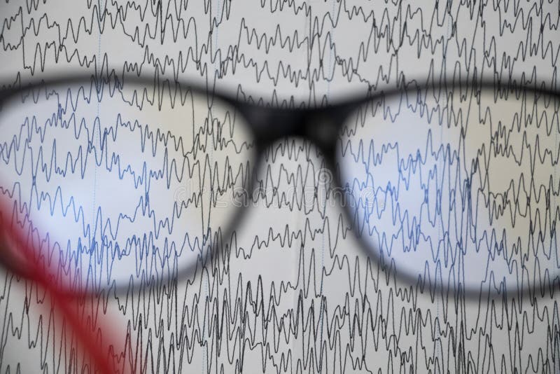 A Neurologist Examines an Encephalogram of a Patientâ€™s Brain ...