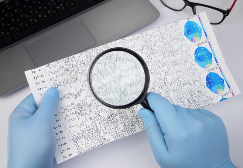 A Neurologist Examines an Encephalogram of a Patientâ€™s Brain ...