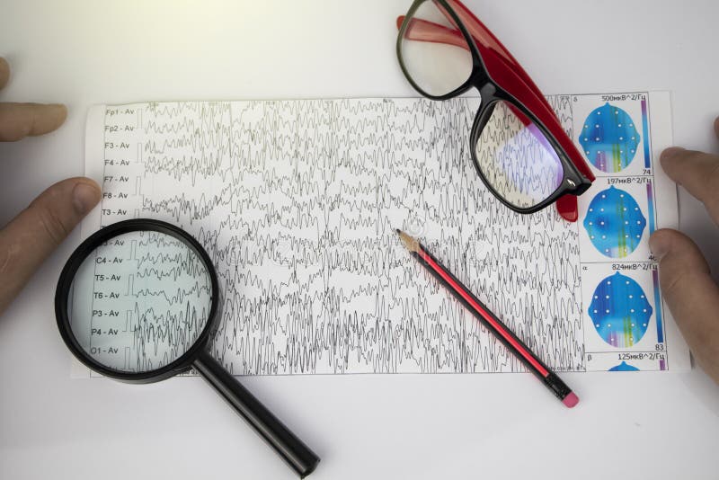 Doctor Examines Electrocardiogram Stock Photos - Free & Royalty-Free ...