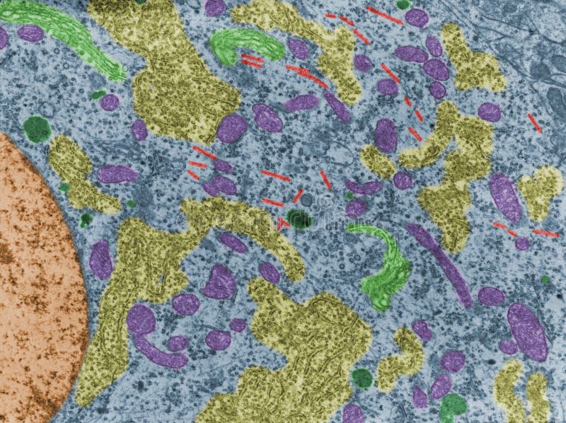 Cell nucleus. TEM stock photo. Image of electron, ultrastructure ...