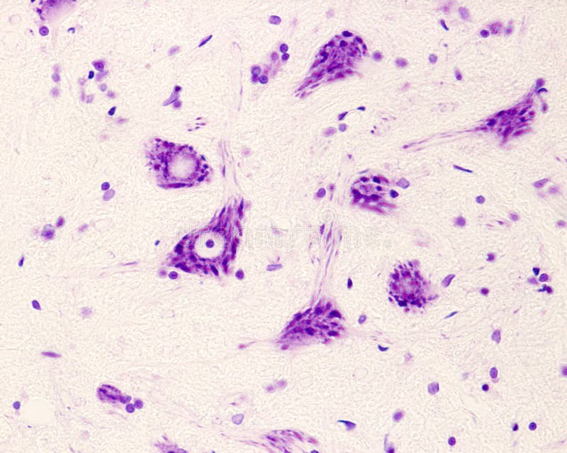 Neuronas Motoras. Cuerpos De Nissl Foto de archivo - Imagen de sistema ...