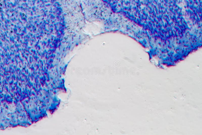 Neuronas Hippocampal Del Cerebro De La Rata Foto de archivo - Imagen de ...