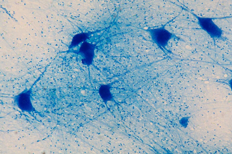 Neuronas De Motor Debajo Del Microscopio Foto de archivo - Imagen de ...