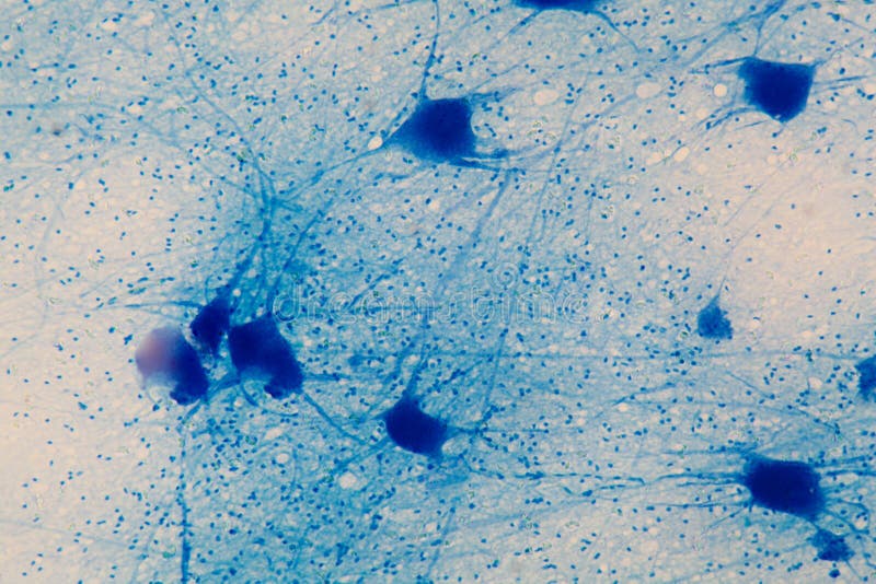 Neuronas De Motor Debajo Del Microscopio Foto de archivo - Imagen de ...