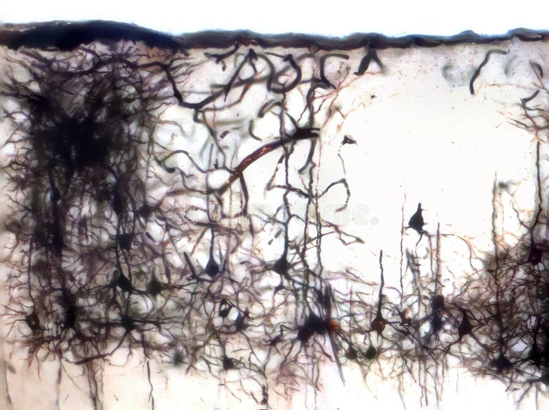 Golgi stain, brain stock image. Image of microscope - 327438755