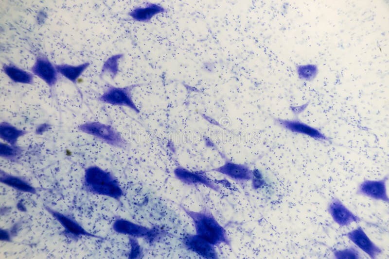 Neurons Cells from the Brain Stock Photo - Image of human, biological ...