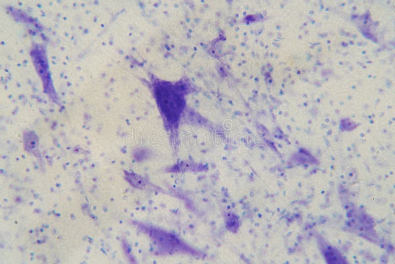 Neurons Cells from the Brain Under the Microscope View Stock Photo ...