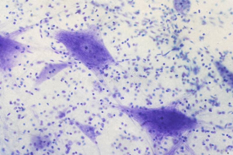 Neurons Cells from the Brain Under the Microscope View. Stock Image ...