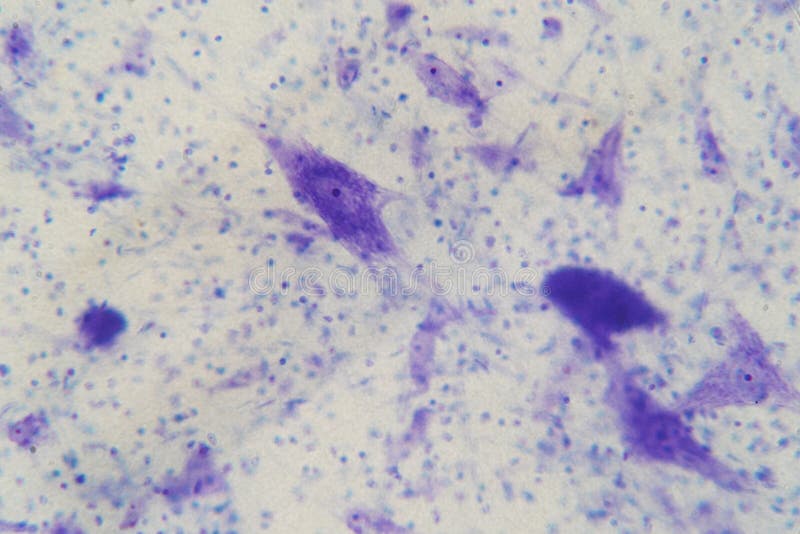 Neurons Cells from the Brain Under the Microscope View Stock Image ...