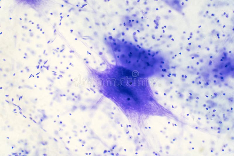 Neurons Cells from the Brain Under the Microscope View Stock Image ...