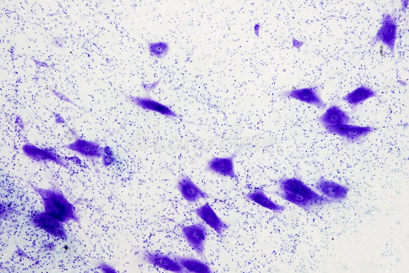 Neurons Cells from the Brain Under Microscope View Stock Photo - Image ...