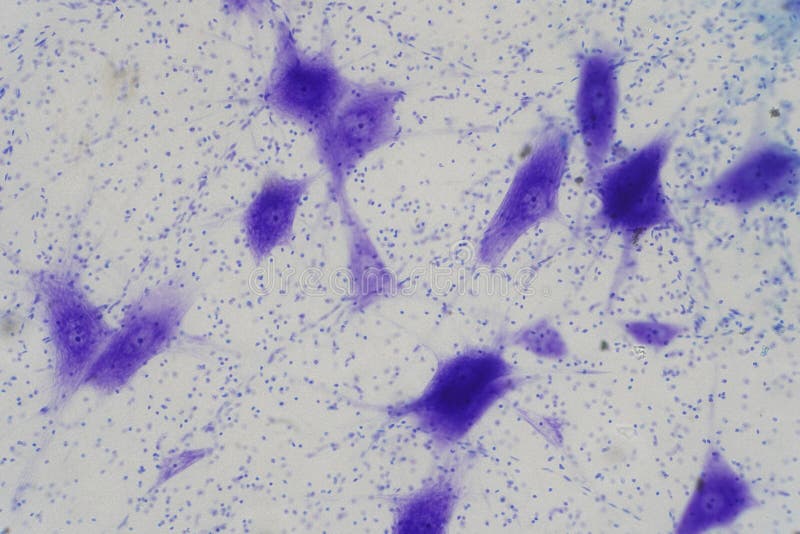 Neurons Cells from the Brain Under the Microscope View Stock Image ...