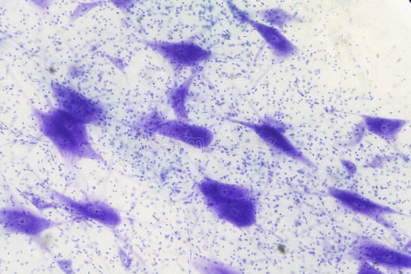 Neurons Cells from the Brain Under the Microscope View Stock Photo ...