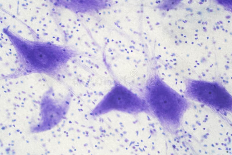 Neurons Cells from the Brain Under the Microscope View. Stock Image ... Neurons Cells from the Brain Under the Microscope View. Stock Image ...