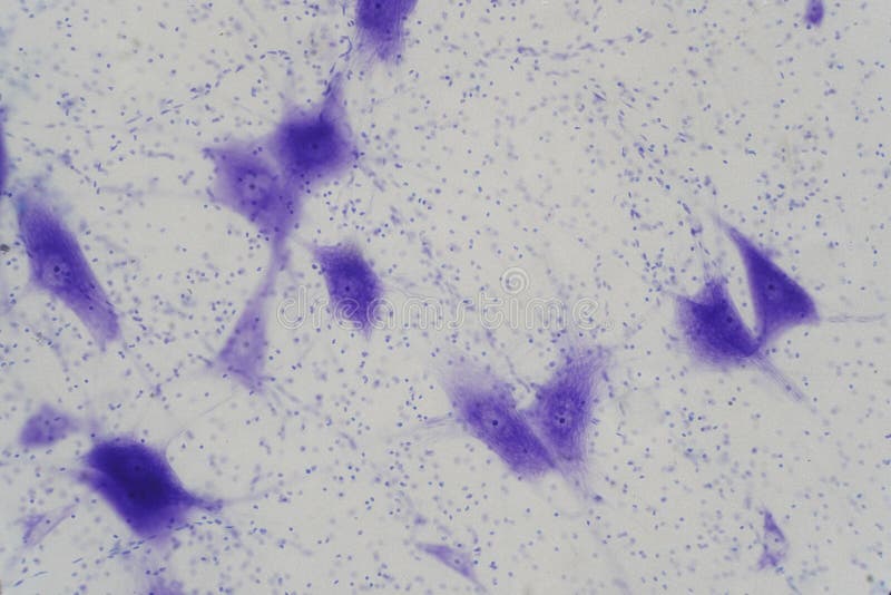 Neurons Cells from the Brain Under the Microscope View. Stock Image ...