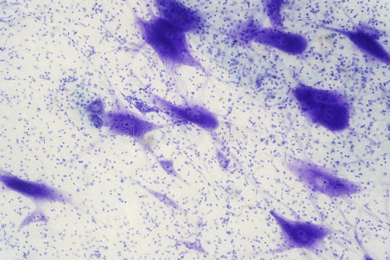 Neurons Cells from the Brain Under the Microscope View Stock Image ...