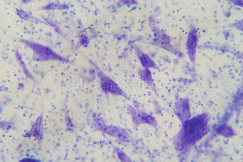 Neurons Cells from the Brain Under the Microscope View Stock Photo ...