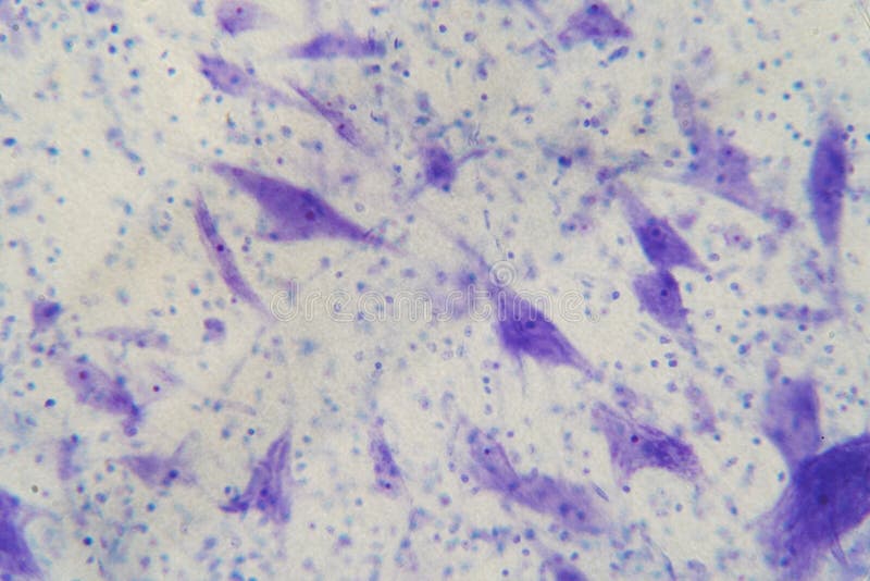 Neurons Cells from the Brain Under the Microscope View Stock Image ...