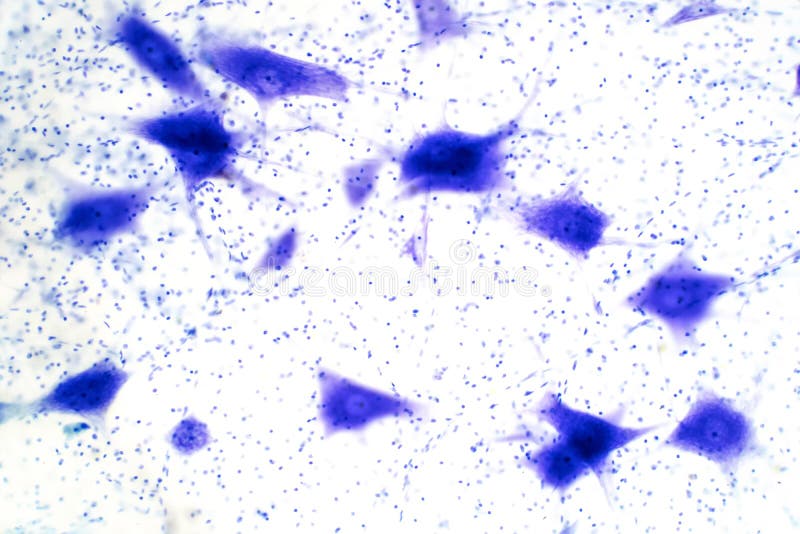 Neurons Cells from the Brain Under the Microscope View Stock Image ...