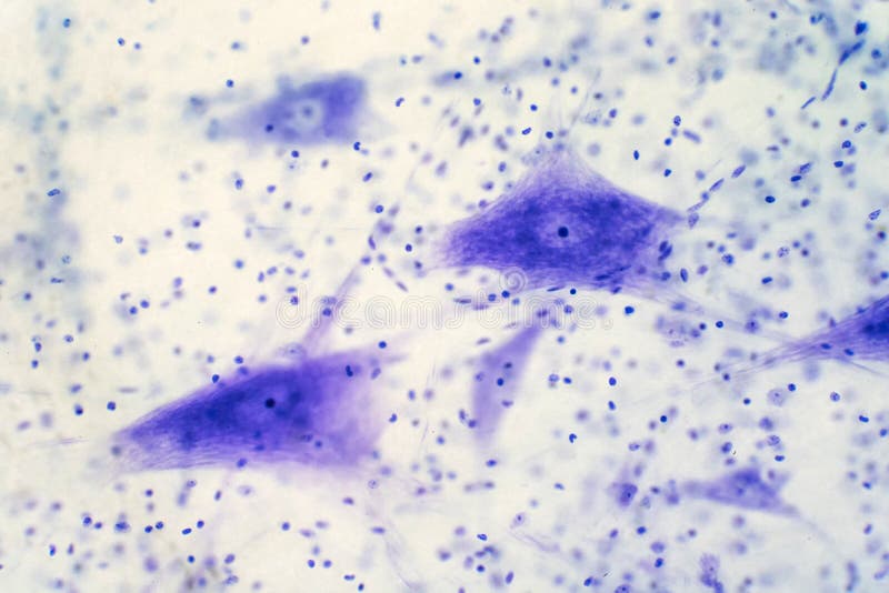 Neurons Cells from the Brain Under the Microscope View Stock Photo ...