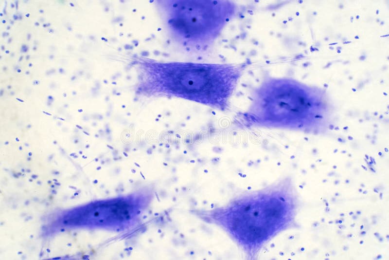 Neurons Cells from the Brain Under the Microscope View Stock Photo ...