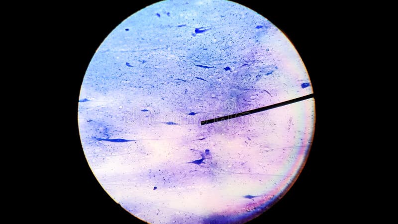 Neurons Cells from the Brain Under the Light Microscope View Stock ...