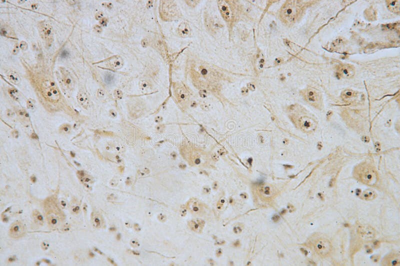 Neurons Cells from the Spinal Cord Stock Photo - Image of body, anatomy ...