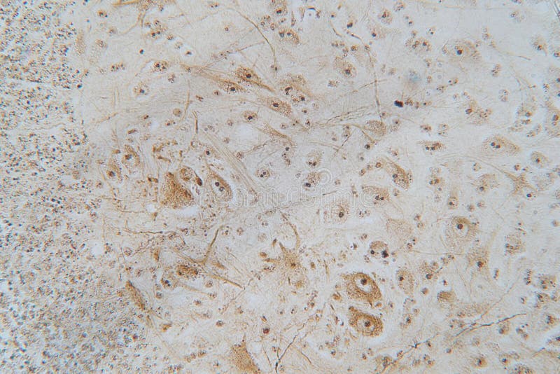 Neurons Cells from the Spinal Cord Under Microscope View. Stock Photo ...