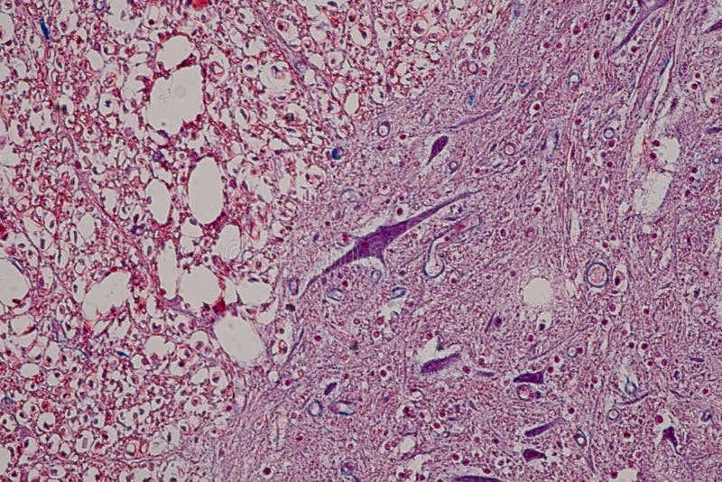 Neurons Cells From The Spinal Cord Under Microscope View Stock Image ...