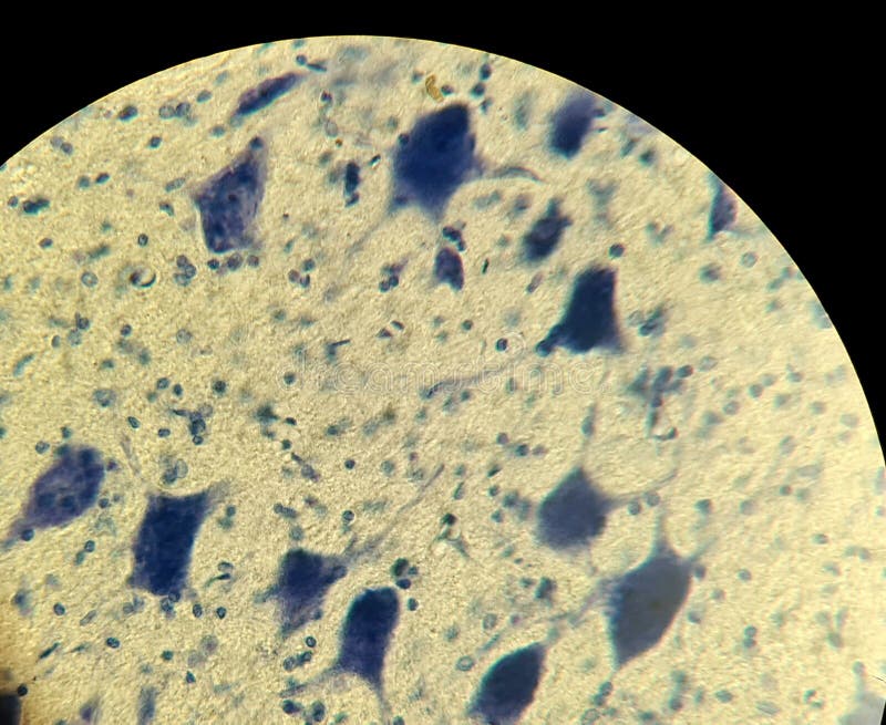 Neurocytes with Processes. Cell Structure of Nervous Tissue Stock Image ...