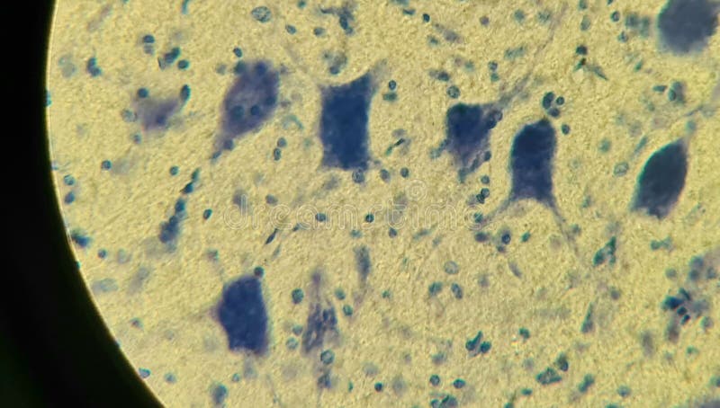 Neurocytes with Processes. Cell Structure of Nervous Tissue Stock Image ...