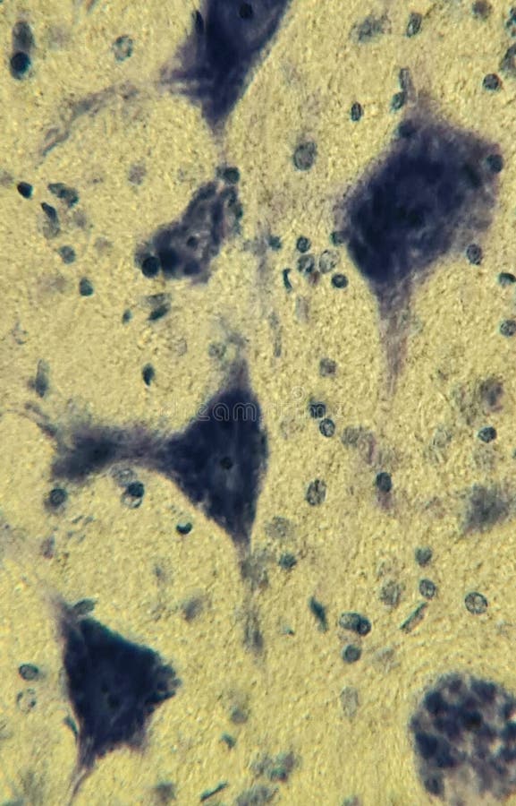 Neurocyte Stock Photos - Free & Royalty-Free Stock Photos from Dreamstime