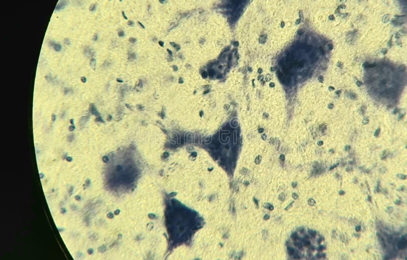 Neurocytes with Processes. Cell Structure of Nervous Tissue Stock Photo ...