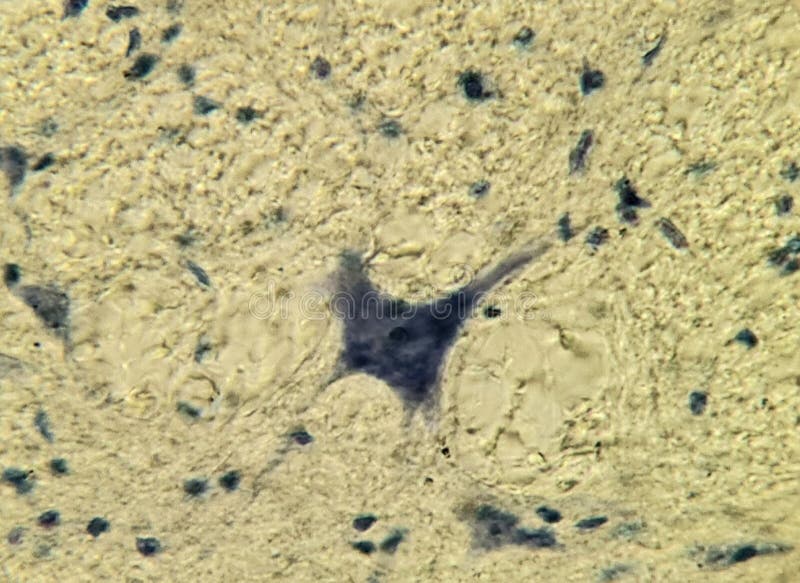 Neurocytes with Processes. Cell Structure of Nervous Tissue Stock Image ...