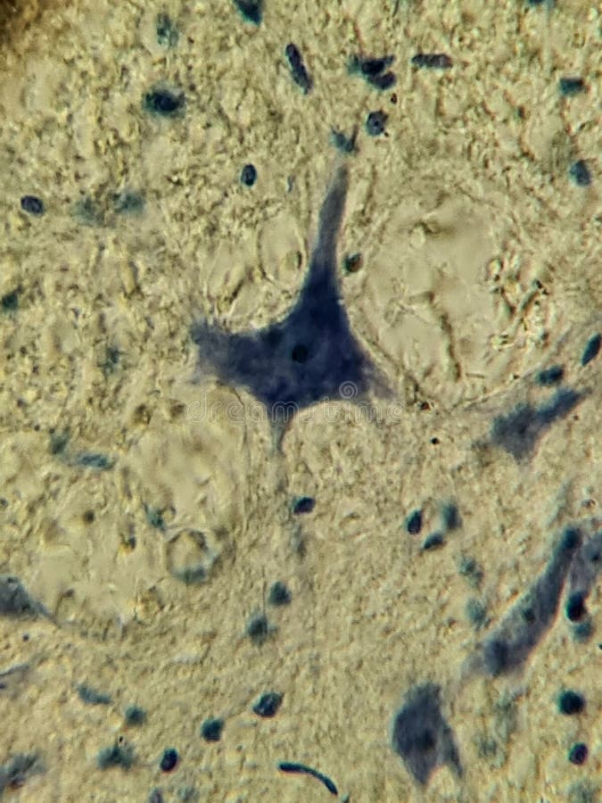 Neurocytes with Processes. Cell Structure of Nervous Tissue Stock Photo ...