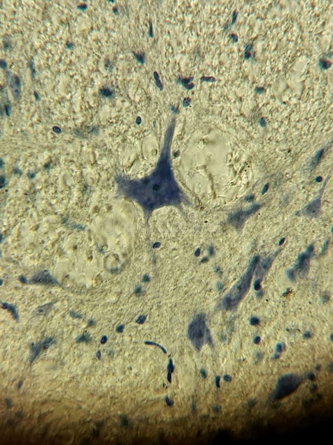 Neurocytes with Processes. Cell Structure of Nervous Tissue Stock Image ...