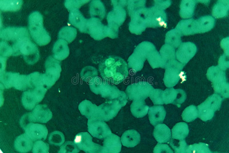 Imagen Del Microscopio De Fluorescencia De Las Células Que Experimentan ...