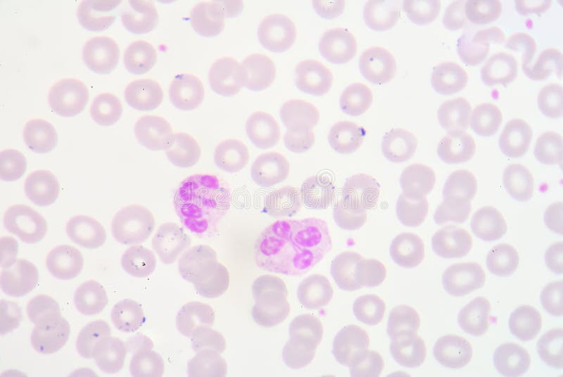 Segmentados Fotos - Fotos de Stock Gratuitas e Fotos Royalty-Free ...