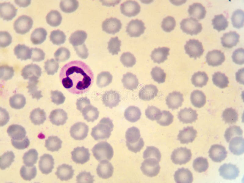Neutrophil cell stock image. Image of analyzing, hematology - 99829603