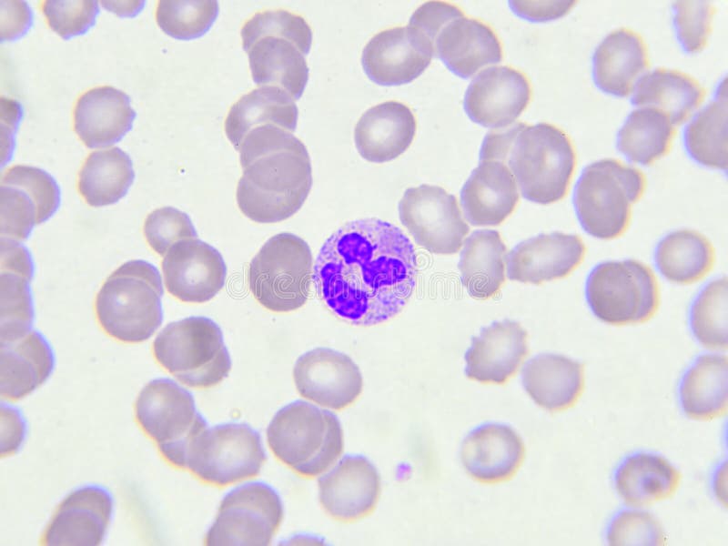 Neutrophil cell stock photo. Image of checkup, laboratory - 97102014