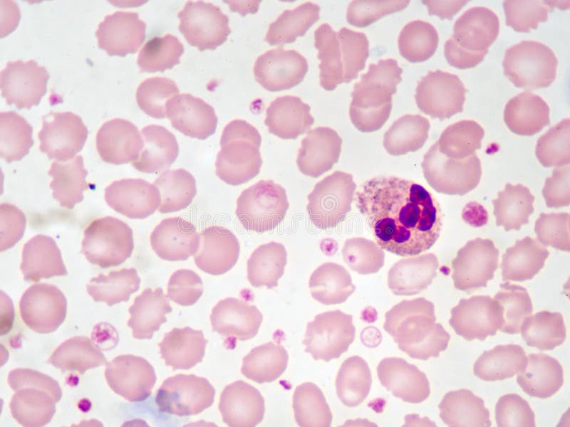 Neutrophil cell stock image. Image of checkup, exam, leukocyte - 99629239