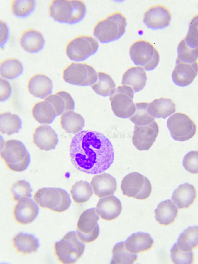 Neutrophil Cell In Blood Smear Stock Image - Image of hematopoiesis ...