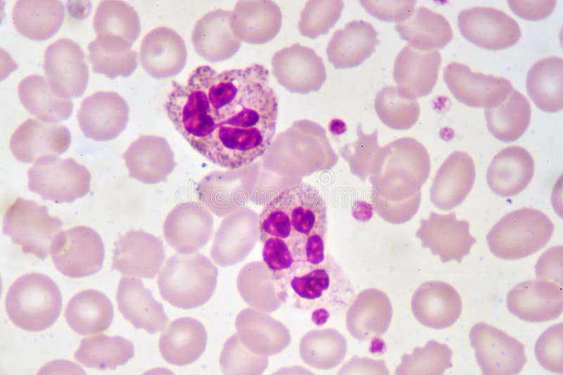 Neutrophil cells stock photo. Image of leukocyte, lymphocyte - 92593846