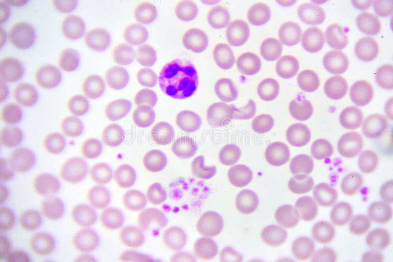 Neutrophil cells stock photo. Image of leukocyte, lymphocyte - 92593846