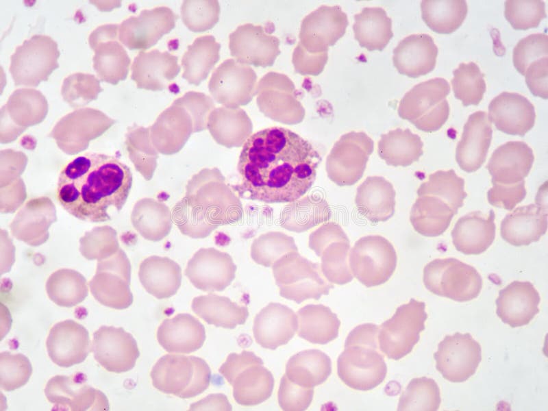 Neutrophil cells stock image. Image of hematology, analyzing - 112054313