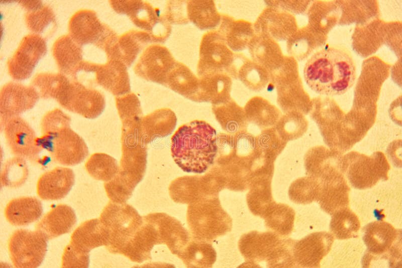 Neutrophil and Eosinophilic Granulocyte Stock Photo - Image of cell ...