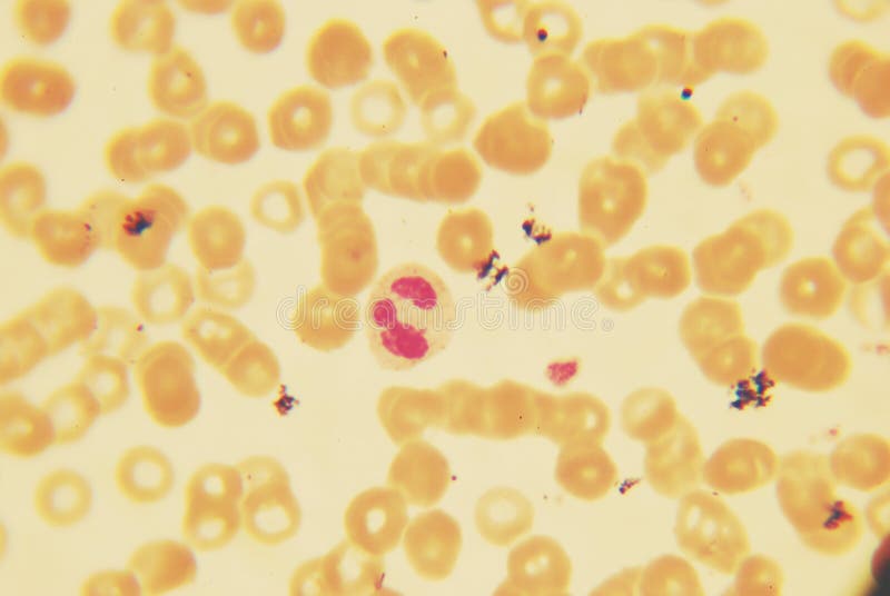 Neutrophil stock photo. Image of deoxyribonucleic, immersion - 42788350